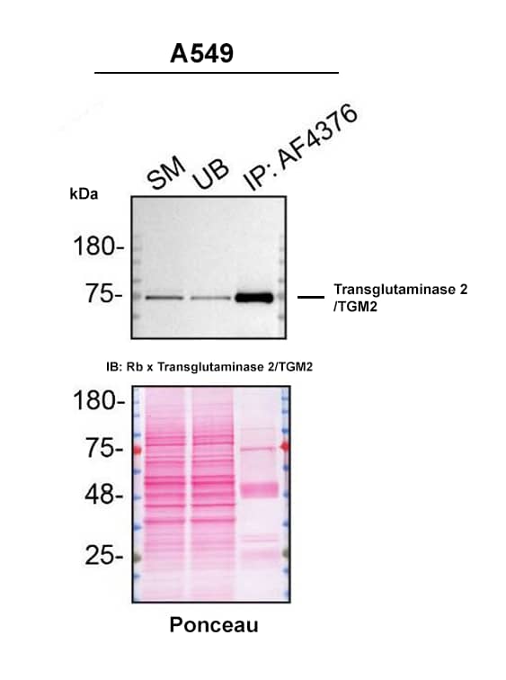 Human/Mouse/Rat Transglutaminase 2/TGM2 Antibody (AF4376) by R&D ...
