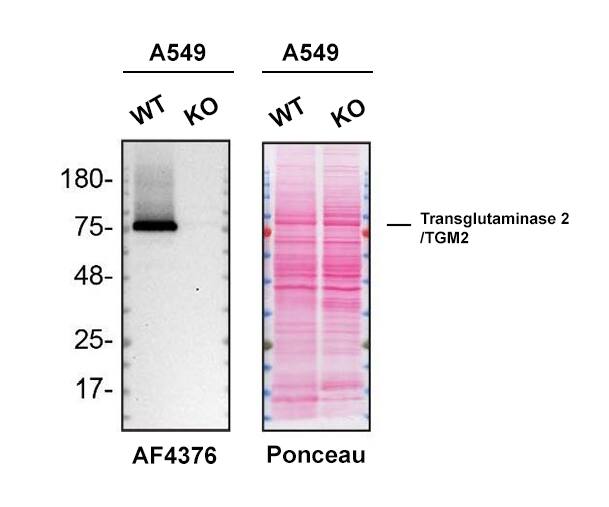 Human/Mouse/Rat Transglutaminase 2/TGM2 Antibody (AF4376) by R&D ...