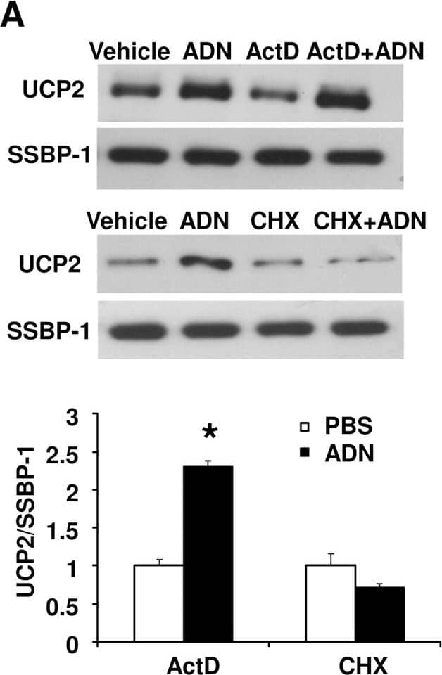 Human/Mouse UCP2 Antibody (AF4739) by R&D Systems, Part of Bio-Techne