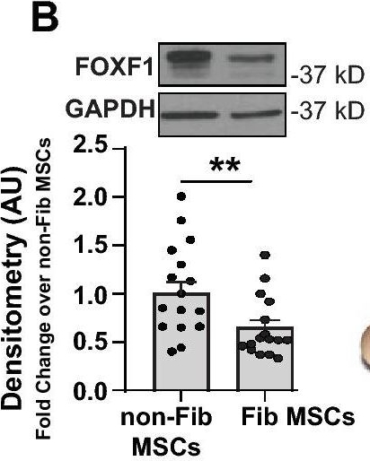 Human FoxF1 Antibody (AF4798) by R&D Systems, Part of Bio-Techne