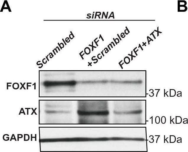Human FoxF1 Antibody (AF4798) by R&D Systems, Part of Bio-Techne