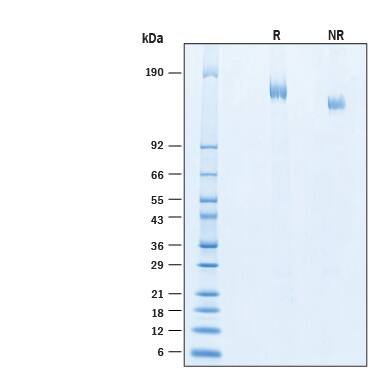 Recombinant SARS-CoV-2 BA.2 S His Alexa Fluor® 488 Protein (AFG11109) by R&D Systems, Part of ...