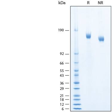 Recombinant SARS-CoV-2 BA.4/BA.5 S Alexa Fluor® 488 Protein (AFG11231) by R&D Systems, Part of ...