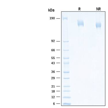 Recombinant SARS-CoV-2 S GCN4-IZ Alexa Fluor® 647 Protein (AFR10561) by R&D Systems, Part of Bio ...