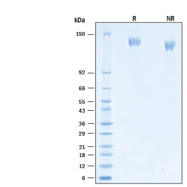 Recombinant SARS-CoV-2 S GCN4-IZ Alexa Fluor® 647 Protein (AFR10786) by R&D Systems, Part of Bio ...