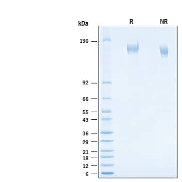 Recombinant SARS-CoV-2 S GCN4-IZ Alexa Fluor® 647 Protein (AFR10796) by R&D Systems, Part of Bio ...