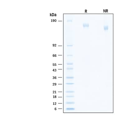 Recombinant SARS-CoV-2 B.1.1.529 S Alexa Fluor® 647 Protein (AFR11060) by R&D Systems, Part of ...