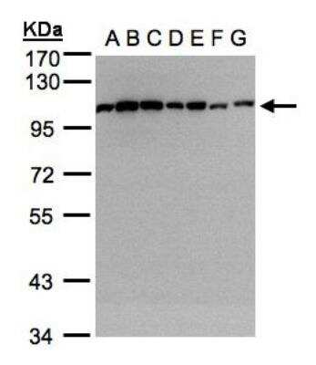alpha-Actinin 1 Antibody (NBP1-32578) by Novus, Part of Bio-Techne