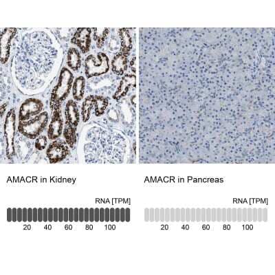 alpha-Methylacyl-CoA Racemase/AMACR Antibody - BSA Free (NBP1-87169) by ...