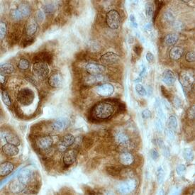 Human Uteroglobin/SCGB1A1 Antibody (AF4218) by R&D Systems, Part of Bio ...