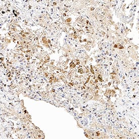 SARS-CoV-2 Spike RBD Antibody (MAB105802) by R&D Systems, Part of Bio-Techne