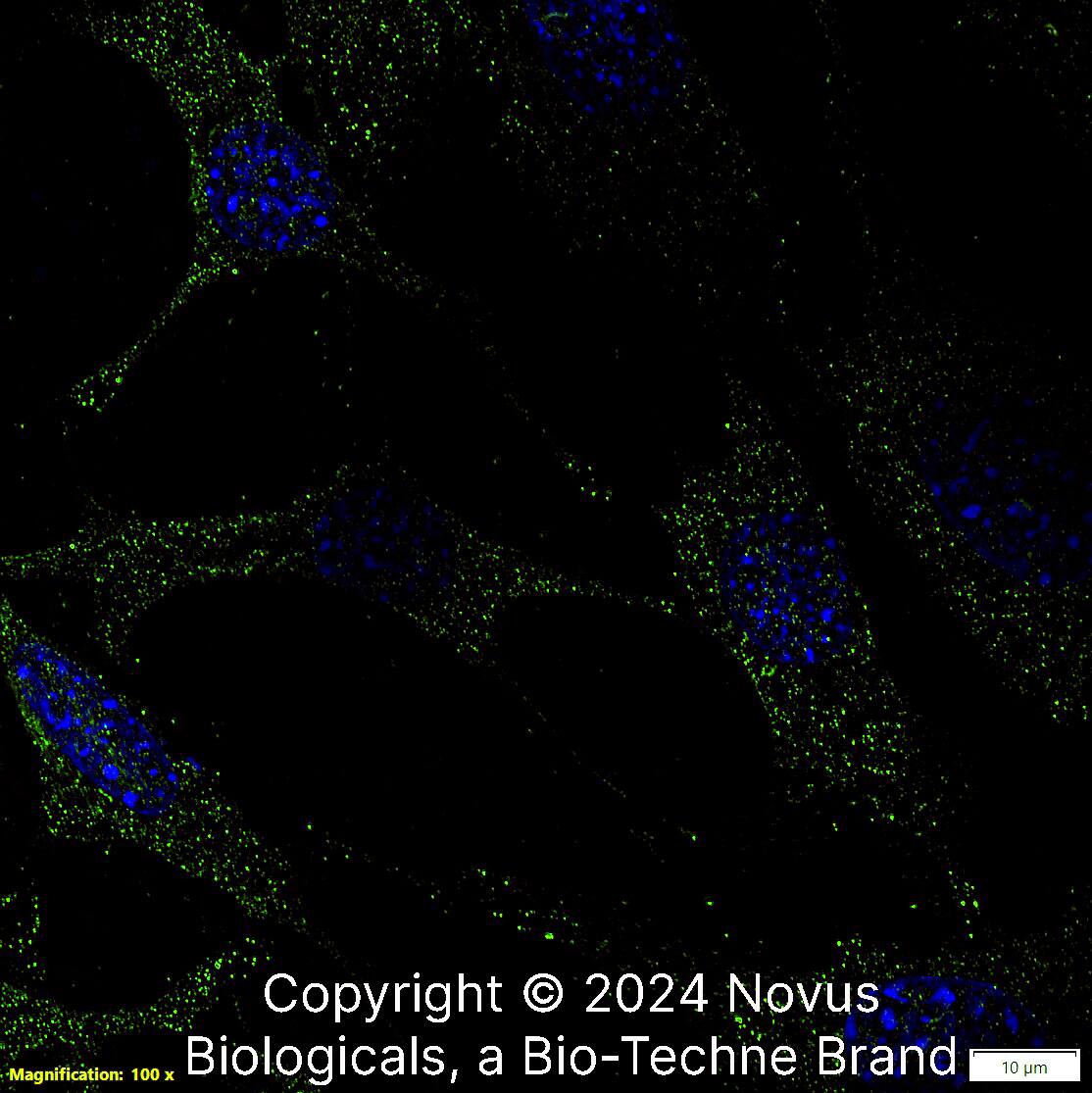 SLC31A1/CTR1 Antibody (NB100-402) by Novus, Part of Bio-Techne