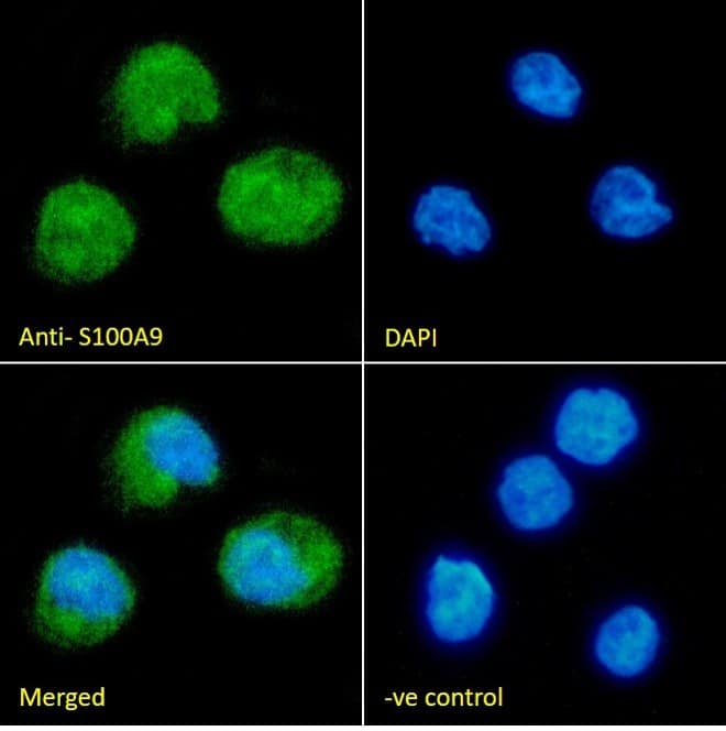 S100A9 Antibody [142Nd] (NBP1-18843) by Novus, Part of Bio-Techne