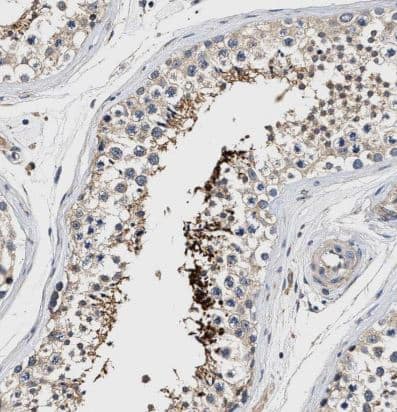 TEX2 Antibody - BSA Free (NBP1-83156) by Novus, Part of Bio-Techne