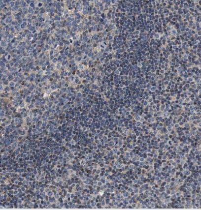 TEX2 Antibody - BSA Free (NBP1-83156) by Novus, Part of Bio-Techne