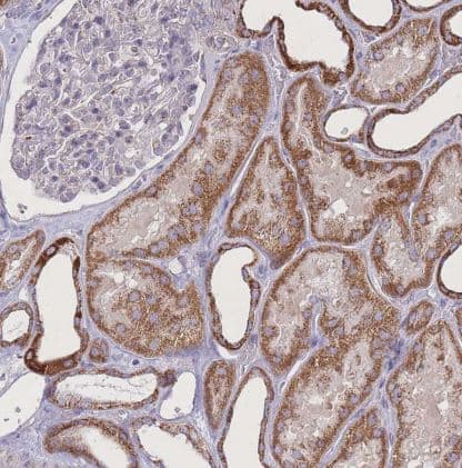 Pyruvate Dehydrogenase E1-alpha subunit Antibody - BSA Free (NBP2-33922 ...