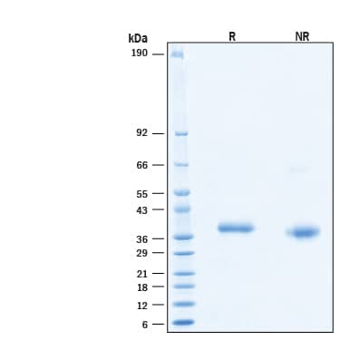 Recombinant SARS-CoV-2 B.1.1.7 S RBD Avi-tag Protein, CF (AVI10730) by R&D Systems, Part of Bio ...
