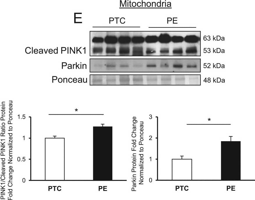 PINK1 Antibody - BSA Free (BC100-494) | Bio-Techne