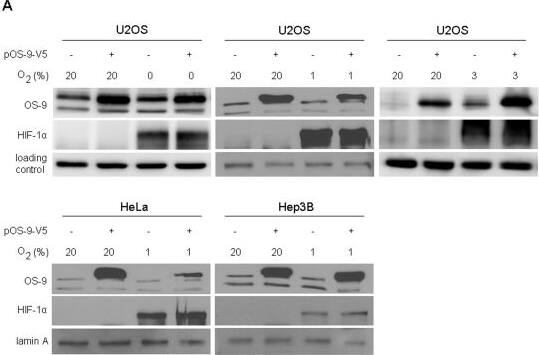 OS9 Antibody (BC100-520) | Bio-Techne