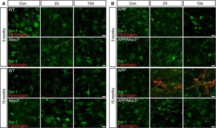 AIF-1/Iba1 Antibody (NB100-1028) | Bio-Techne