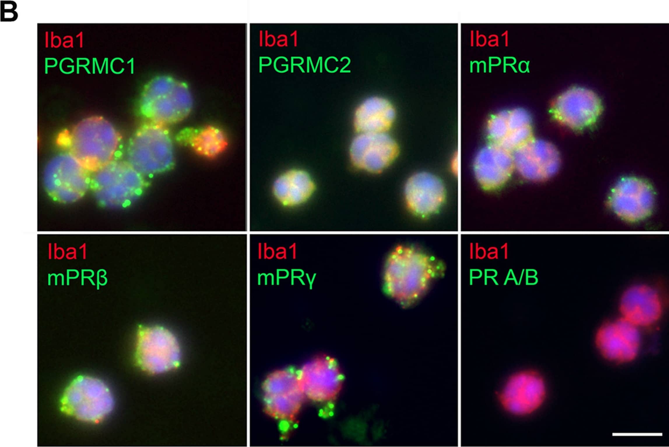 AIF-1/Iba1 Antibody (NB100-1028) | Bio-Techne