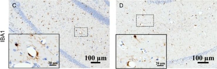 AIF-1/Iba1 Antibody (NB100-1028) | Bio-Techne