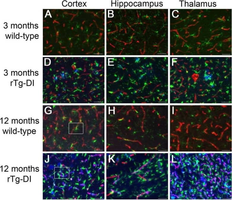 AIF-1/Iba1 Antibody (NB100-1028) | Bio-Techne