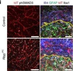 AIF-1/Iba1 Antibody (NB100-1028) | Bio-Techne
