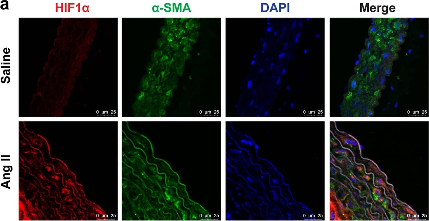 HIF-1 alpha Antibody (H1alpha67) (NB100-105) | Bio-Techne