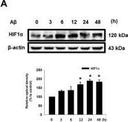 HIF-1 alpha Antibody (H1alpha67) (NB100-105) | Bio-Techne