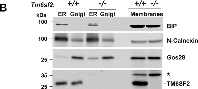 Calnexin Antibody - BSA Free (NB100-1965) | Bio-Techne