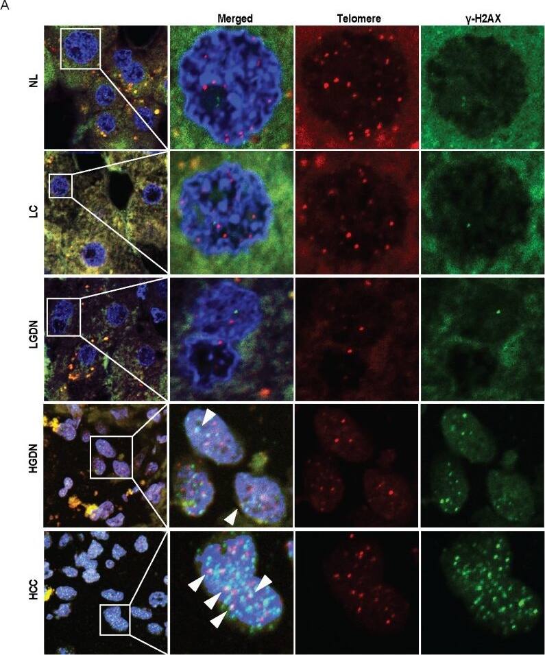 Histone H2AX [p Ser139] Antibody (NB100-2280) | Bio-Techne