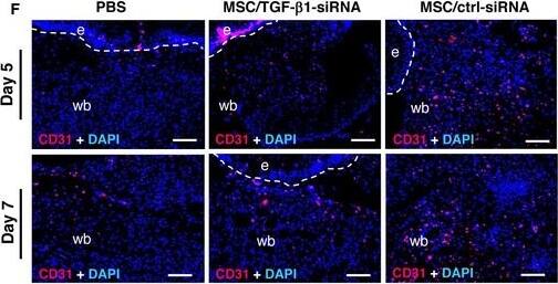 CD31/PECAM-1 Antibody (NB100-2284) | Bio-Techne