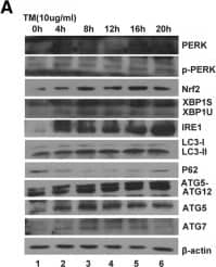 IRE1 alpha [p Ser724] Antibody - BSA Free (NB100-2323) | Bio-Techne