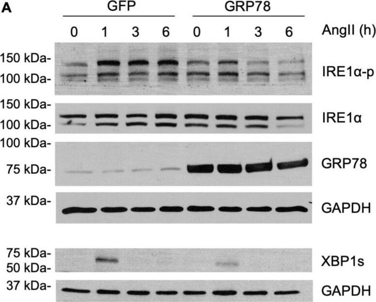 IRE1 alpha [p Ser724] Antibody - BSA Free (NB100-2323) | Bio-Techne