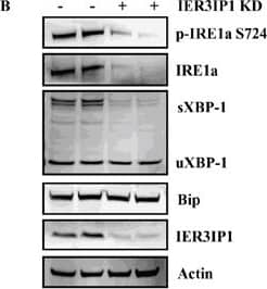 IRE1 alpha [p Ser724] Antibody - BSA Free (NB100-2323) | Bio-Techne