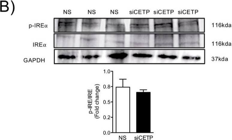 IRE1 alpha [p Ser724] Antibody - BSA Free (NB100-2323) | Bio-Techne