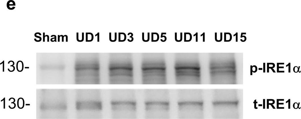 IRE1 alpha [p Ser724] Antibody - BSA Free (NB100-2323) | Bio-Techne