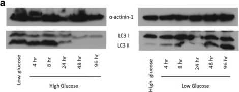 LC3A Antibody - BSA Free (NB100-2331) | Bio-Techne