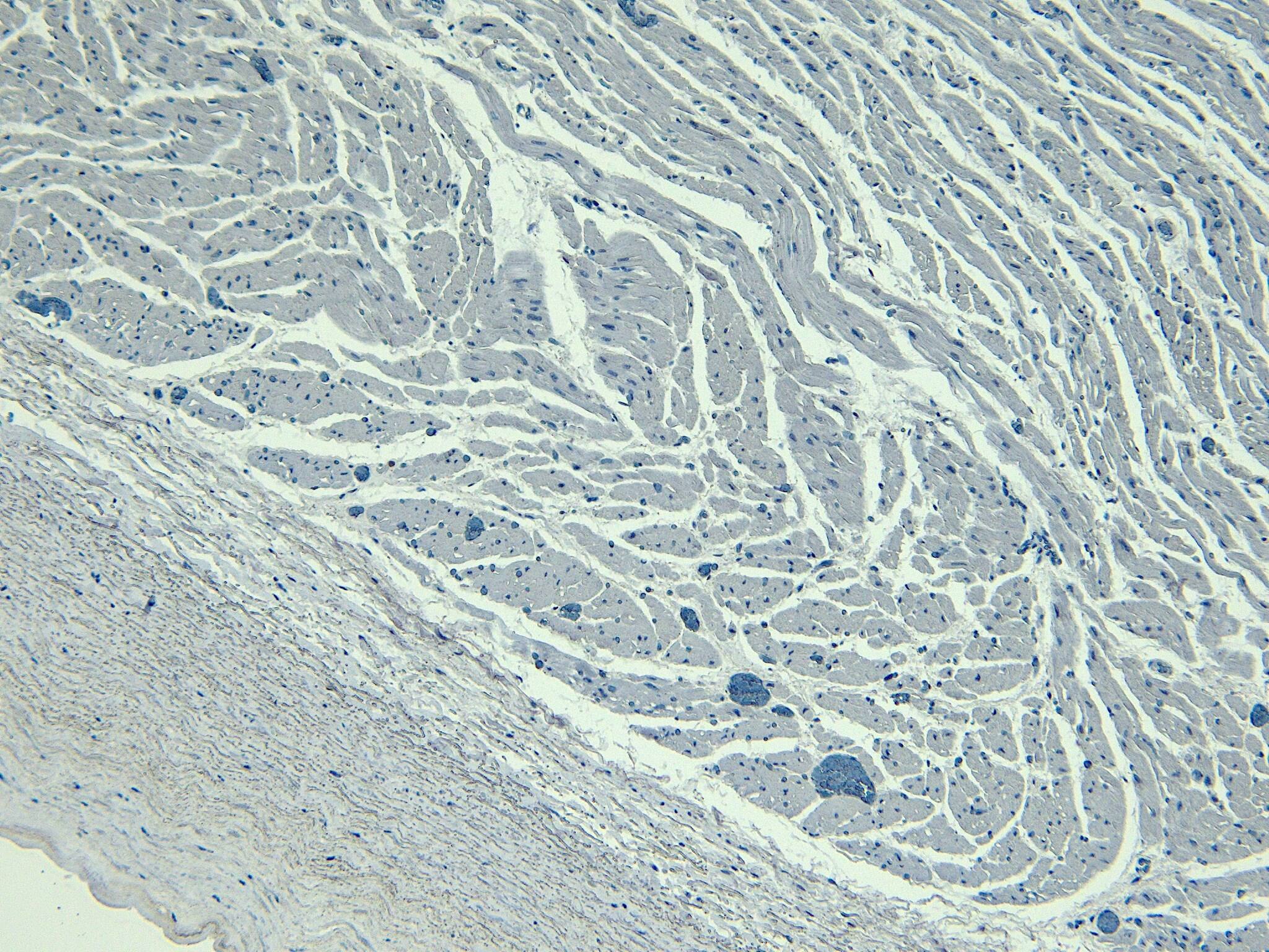 LDB3 Antibody (NB100-2445) by Novus, Part of Bio-Techne