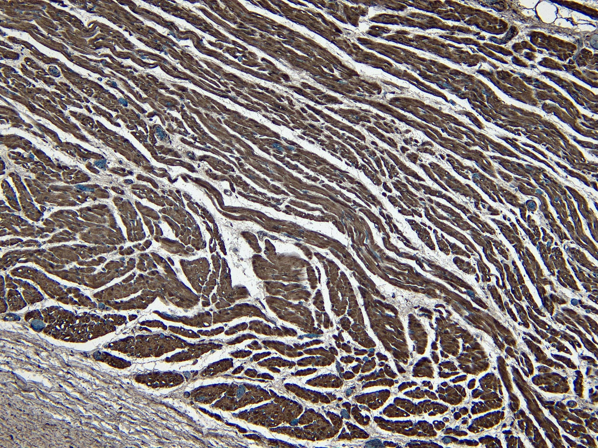 LDB3 Antibody (NB100-2445) by Novus, Part of Bio-Techne