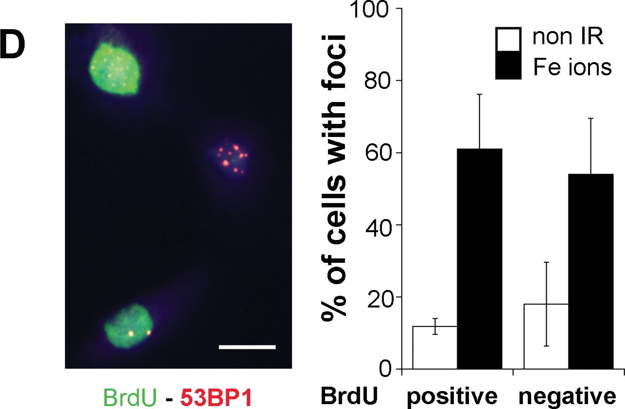 53BP1 Antibody - BSA Free (NB100-304) | Bio-Techne
