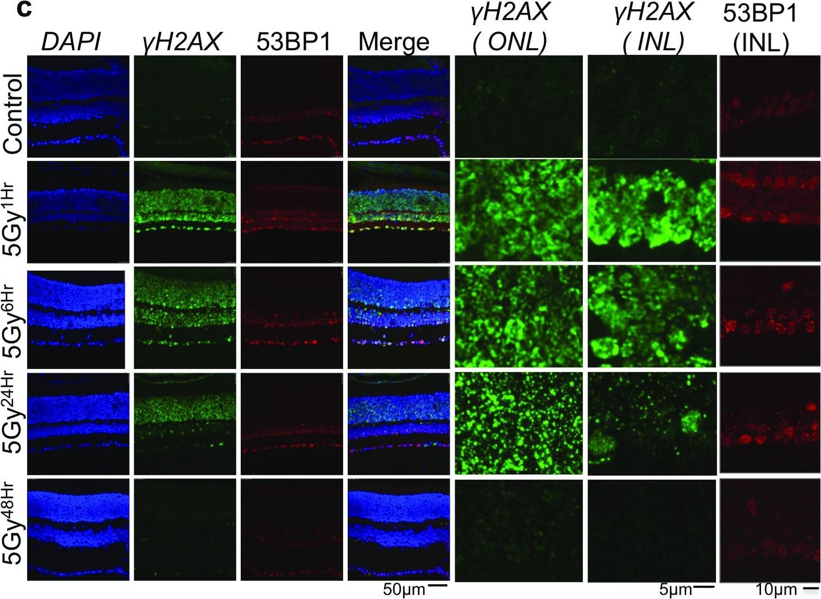53BP1 Antibody - BSA Free (NB100-304) | Bio-Techne