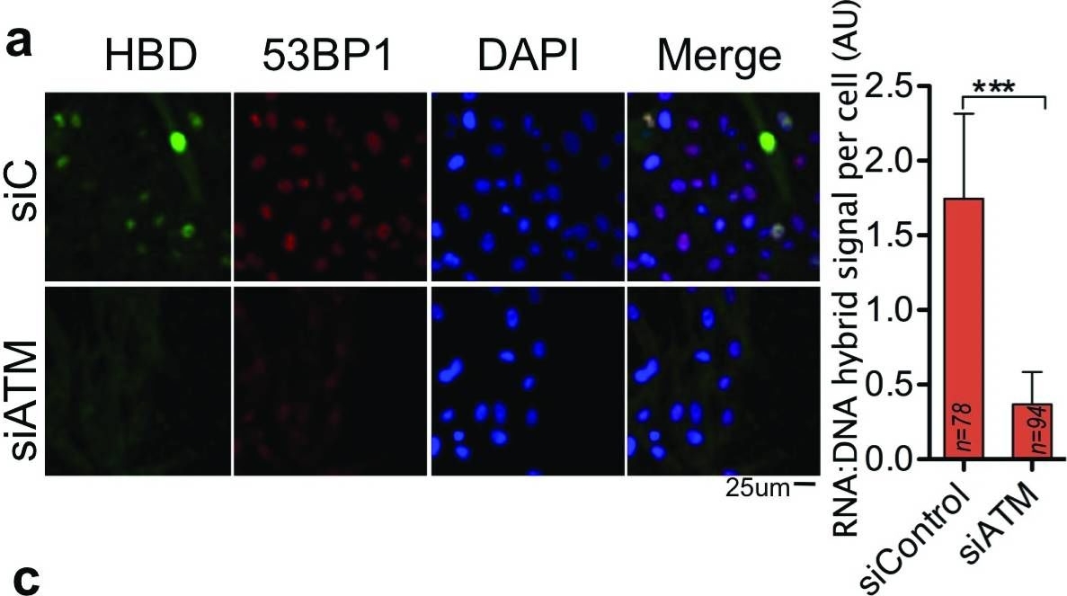53BP1 Antibody - BSA Free (NB100-304) | Bio-Techne