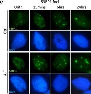 53BP1 Antibody - BSA Free (NB100-304) | Bio-Techne