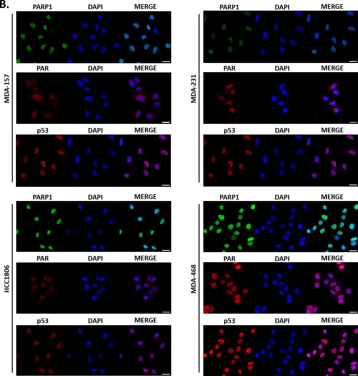 53BP1 Antibody - BSA Free (NB100-304) | Bio-Techne