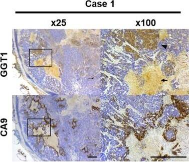 Carbonic Anhydrase IX/CA9 Antibody - BSA Free (NB100-417) | Bio-Techne