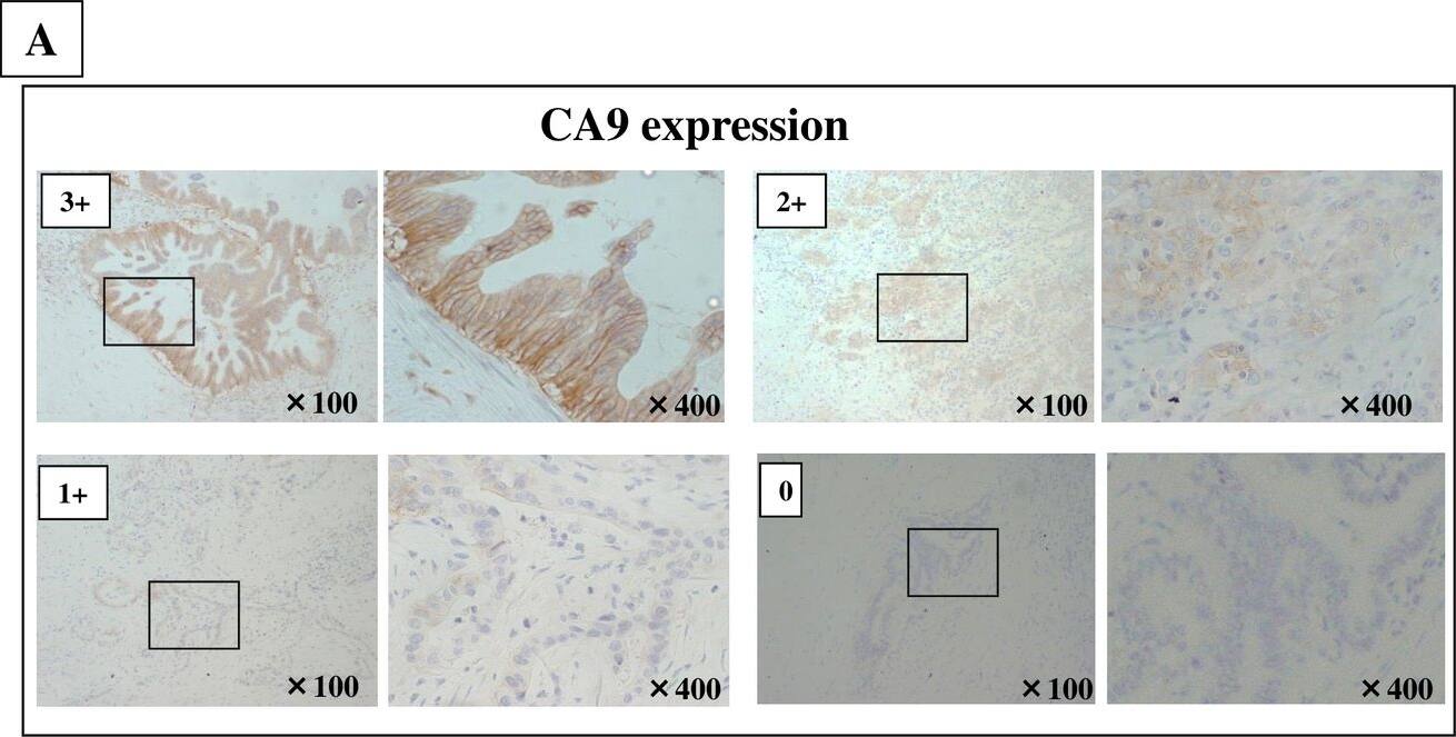 Carbonic Anhydrase IX/CA9 Antibody - BSA Free (NB100-417) | Bio-Techne