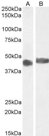 CCM2 Antibody (NB100-53812) by Novus, Part of Bio-Techne