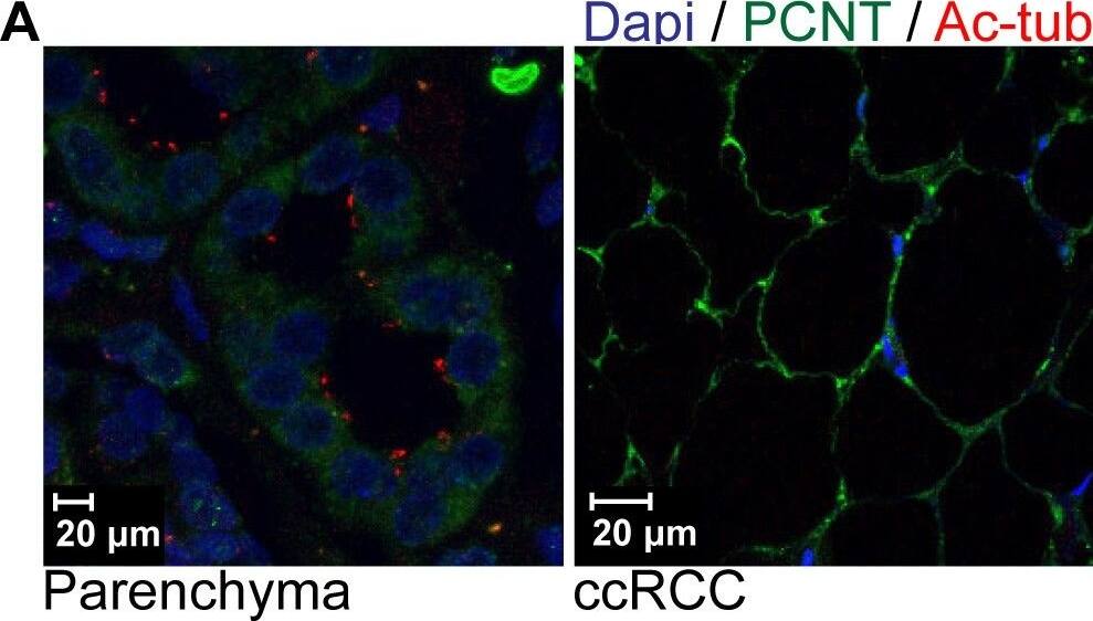 Pericentrin Antibody (NB100-61071) | Bio-Techne